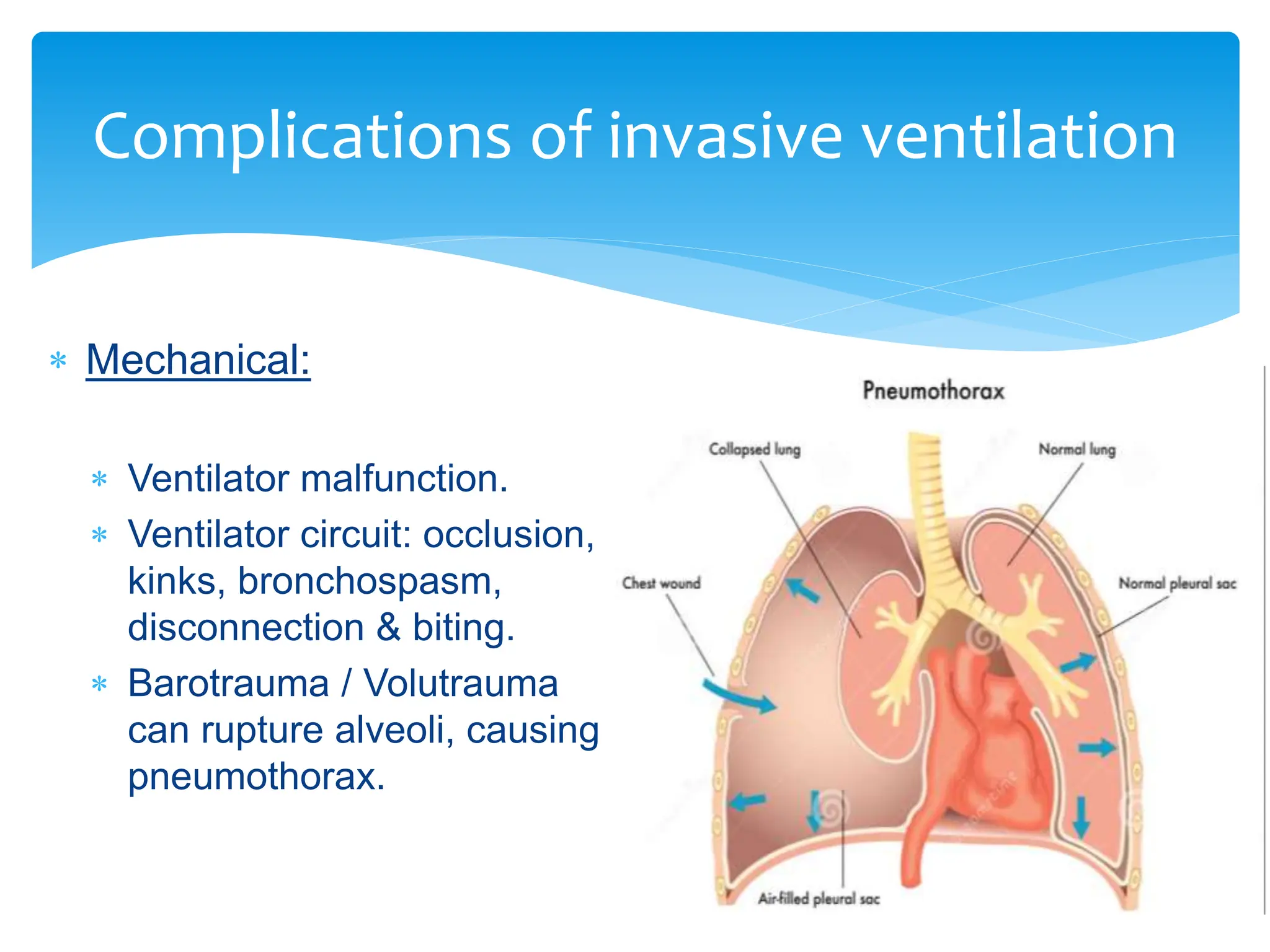 Ventilation types of modes of ventilation.ppt
