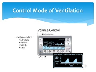 Modes and function of Ventilation Ventilation.ppt
