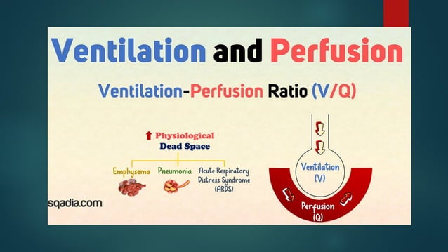 Ventilation-Perfusion Ratio and its .pptx
