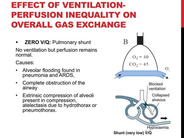 Ventilation perfusion relationships | PPTX