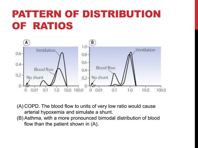 Ventilation perfusion relationships | PPTX