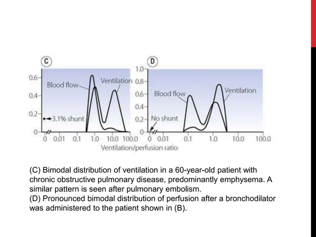 Ventilation perfusion relationships | PPTX