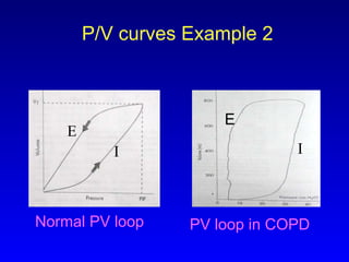 Pneumology - Ventilation physiology-and-work-of-breathing | PPT