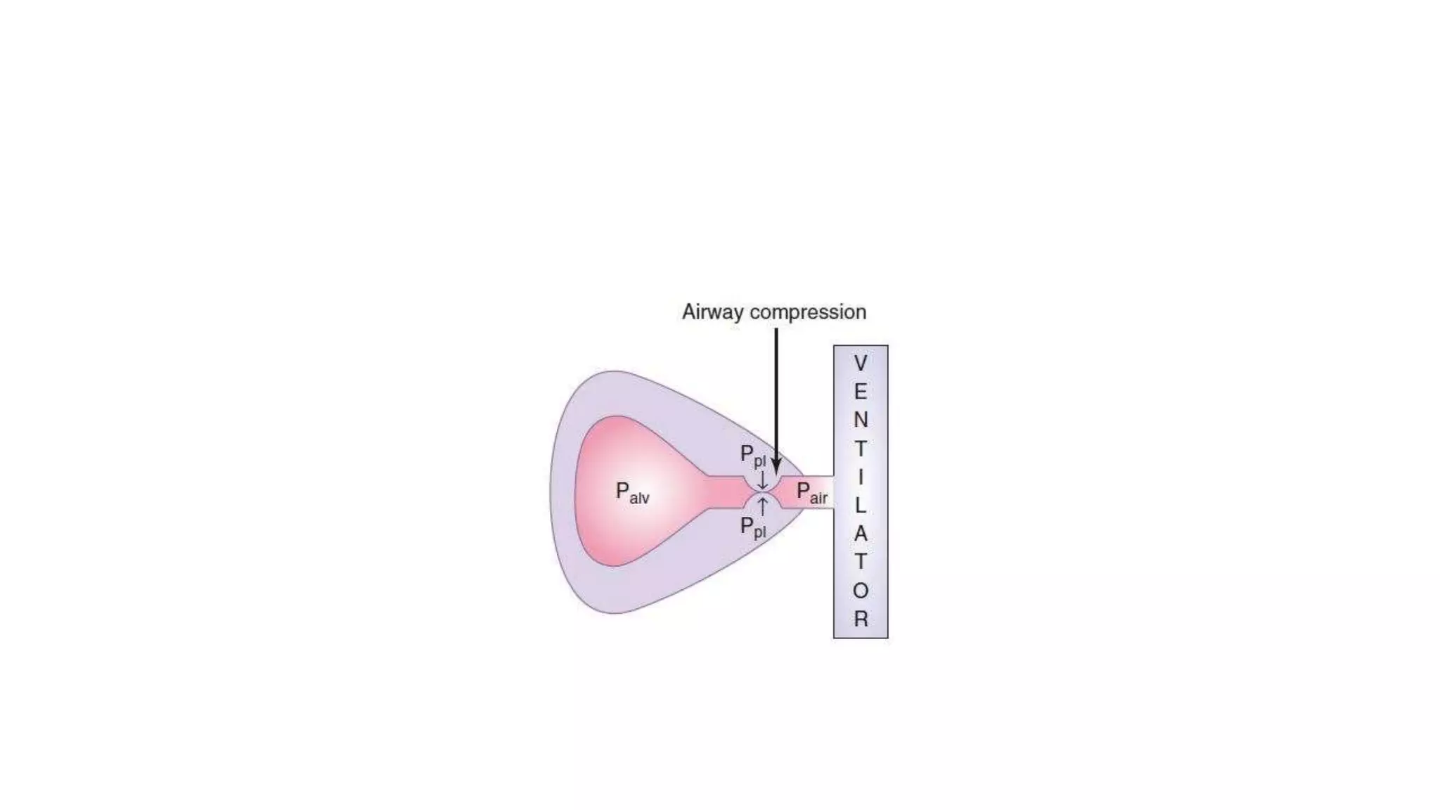 Ventilation 7 patient-ventilator dyssynchrony | PPTX
