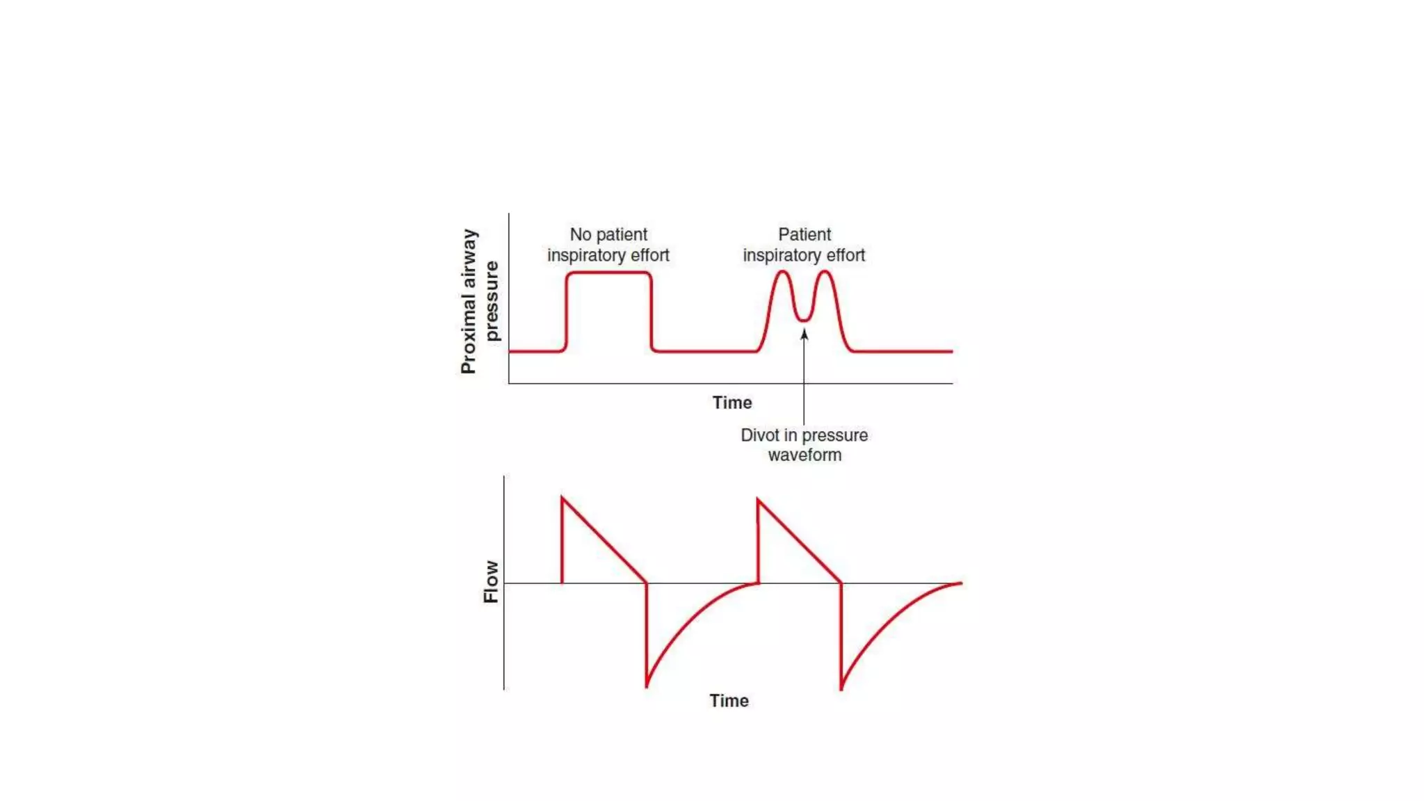 Ventilation 7 patient-ventilator dyssynchrony | PPTX