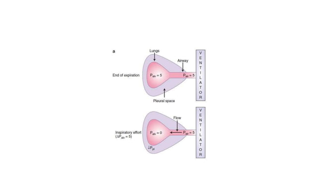 Ventilation 7 patient-ventilator dyssynchrony | PPTX