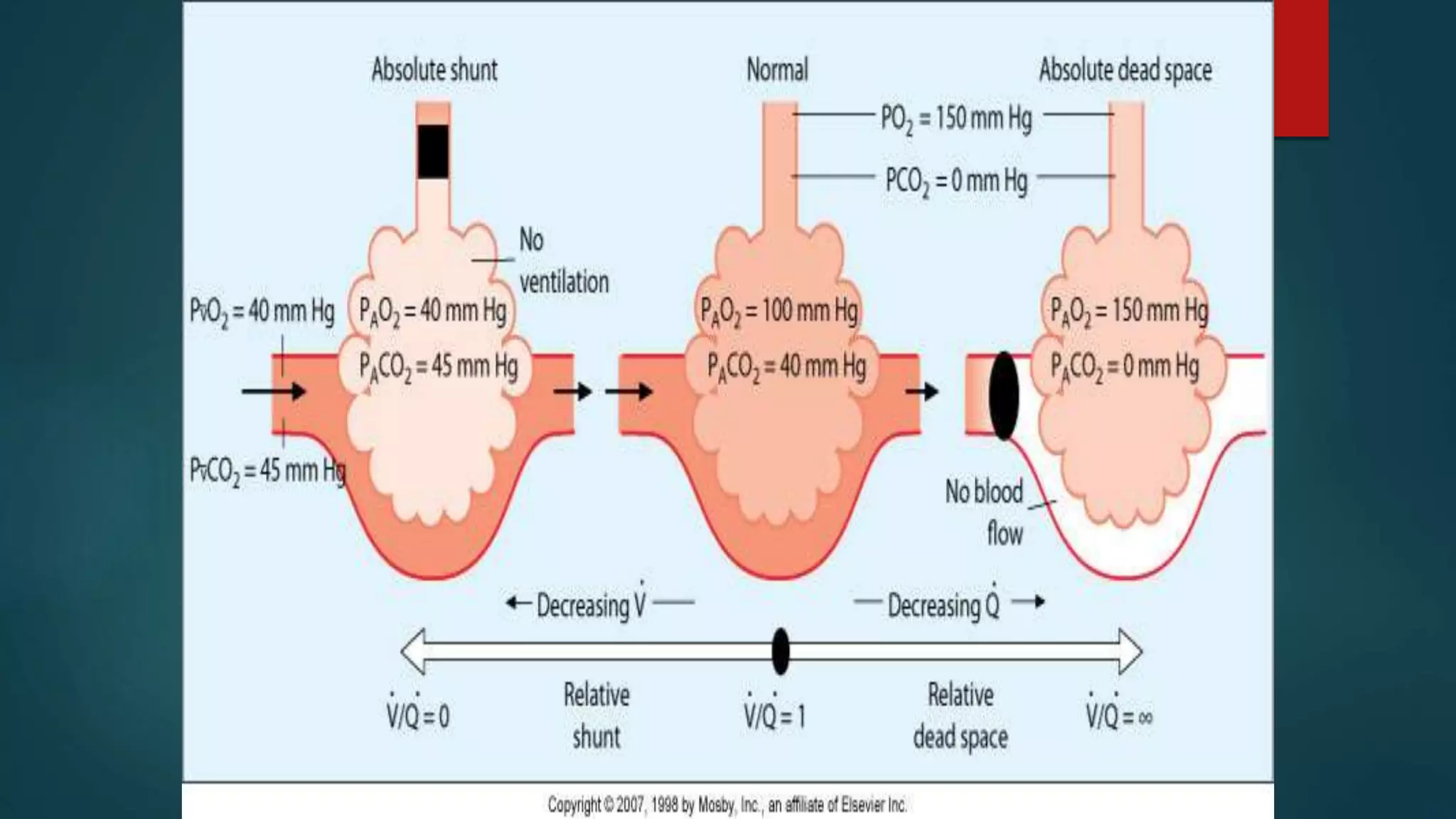 Ventilation and perfusion | PPTX