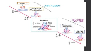 VENTILATION AND PERFUSION FOR NURSING ANATOMY | PPTX