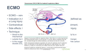 Ventilation in ards by tarun | PPT