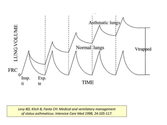 Ventilation in obstructive airway disease | PPTX