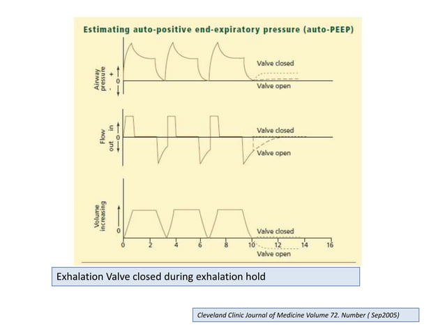 Ventilation in obstructive airway disease | PPTX