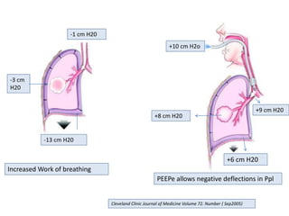 Ventilation in obstructive airway disease | PPTX
