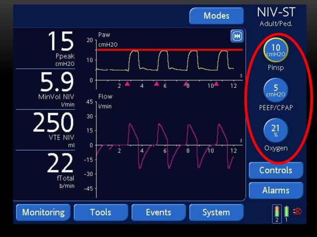 Ventilation Strategy in obstructive Lung disease | PPTX | Lung and ...