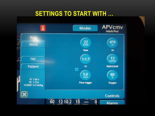 Ventilation Strategy in obstructive Lung disease | PPTX | Lung and ...