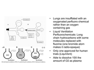 ventilation modalities.pptx