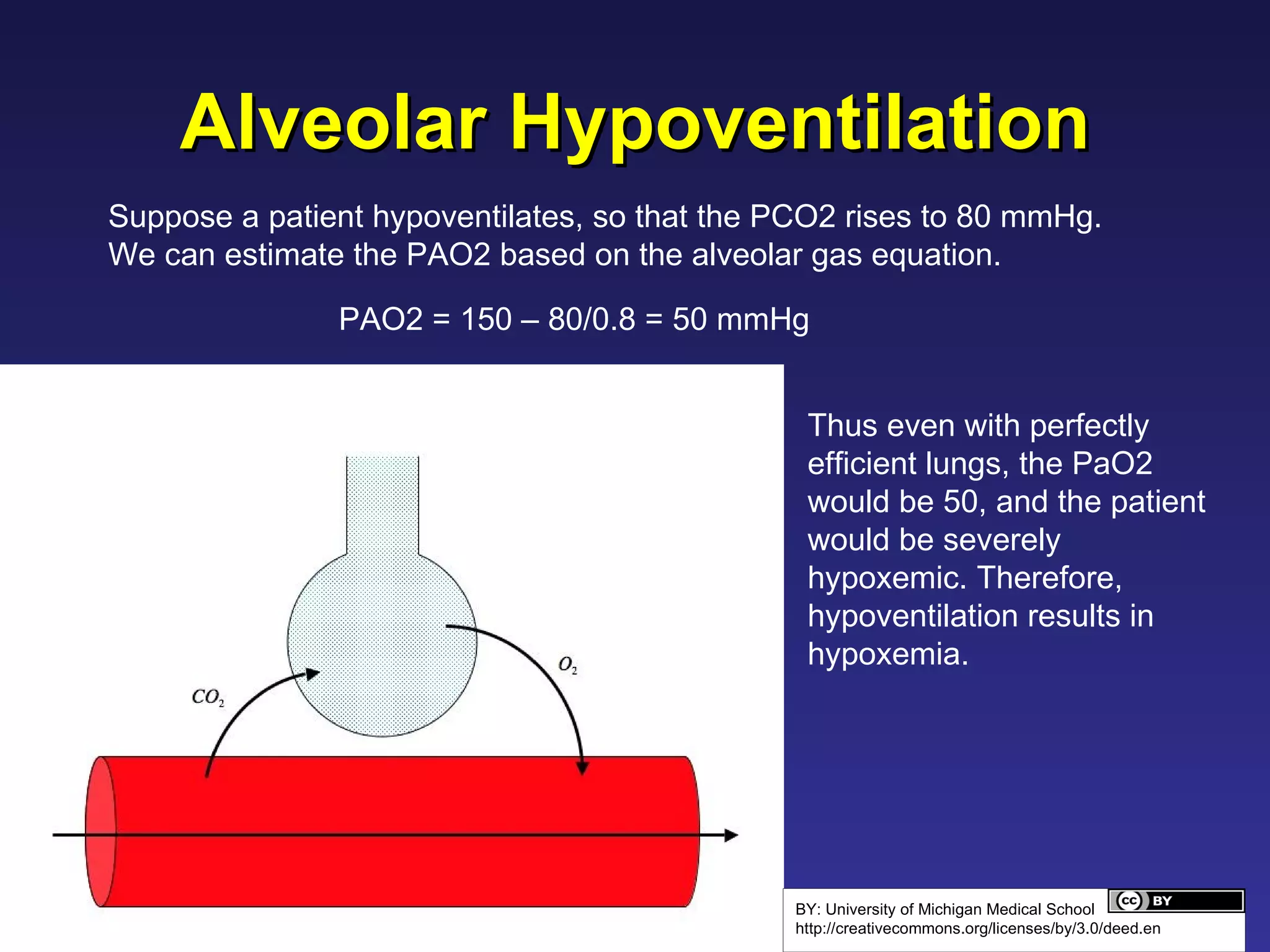 Ventilation Perfusion Matching | PPT