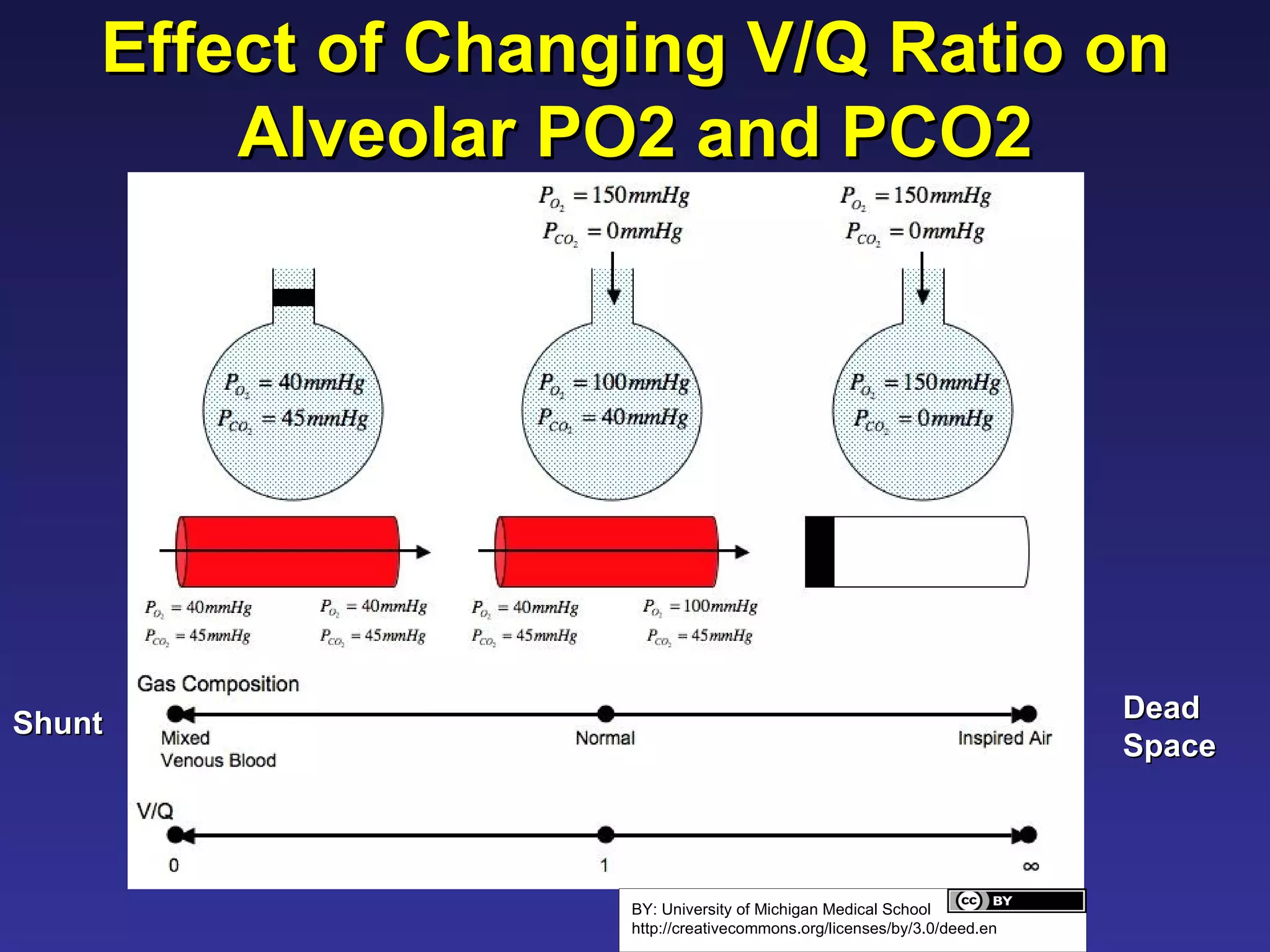 Ventilation Perfusion Matching | PPT