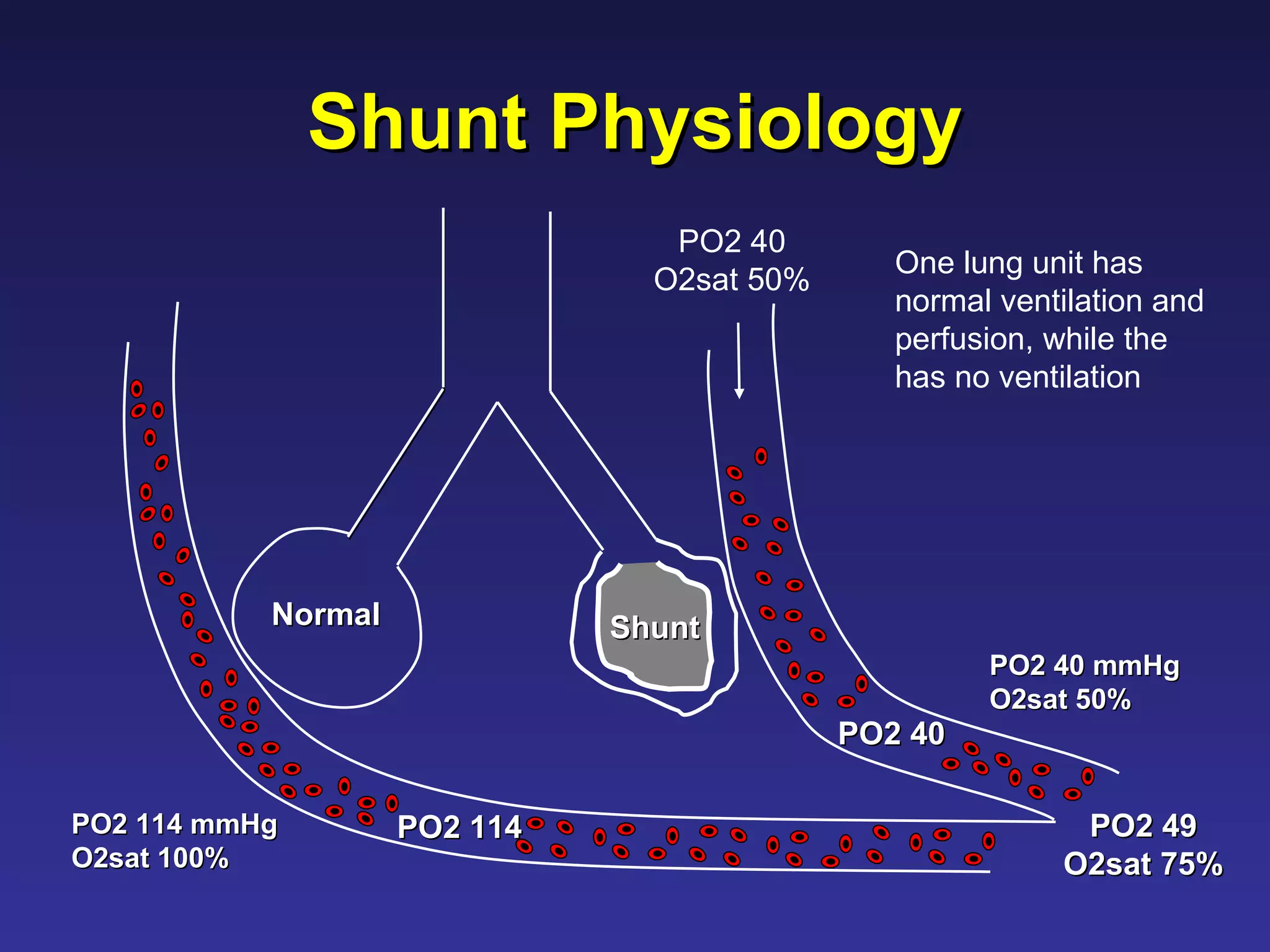 Ventilation Perfusion Matching | PPT