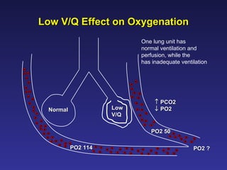 Ventilation Perfusion Matching | PPT