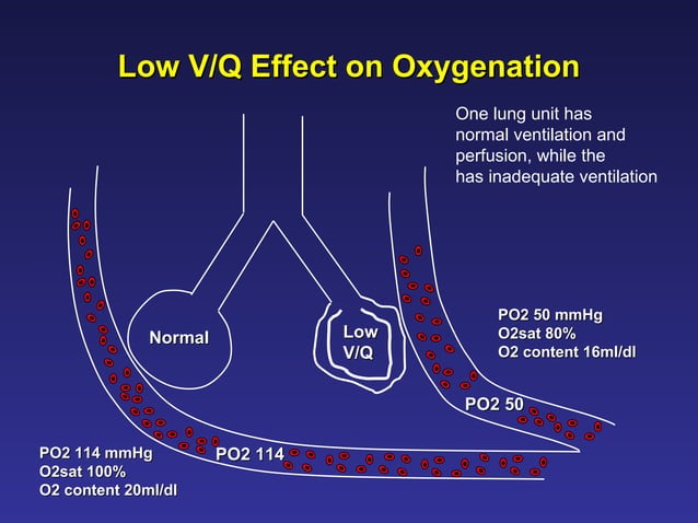 Ventilation Perfusion Matching | PPT