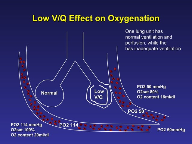 Ventilation Perfusion Matching | PPT