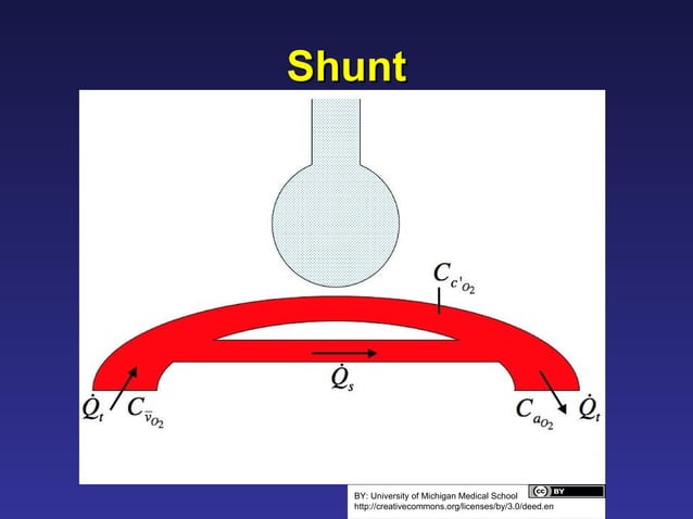 Ventilation Perfusion Matching | PPT