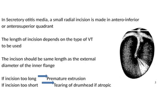 Ventilation Tube Insertion ENT and head neck surgery .pptx
