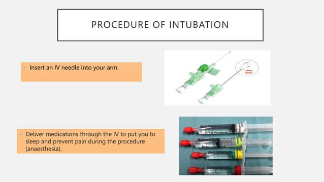 Intubation.pptx | First Aid | Injuries