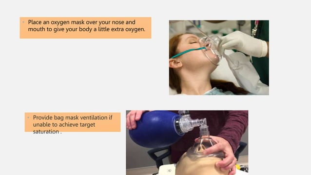 Intubation.pptx | First Aid | Injuries