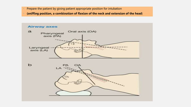 Intubation.pptx | First Aid | Injuries