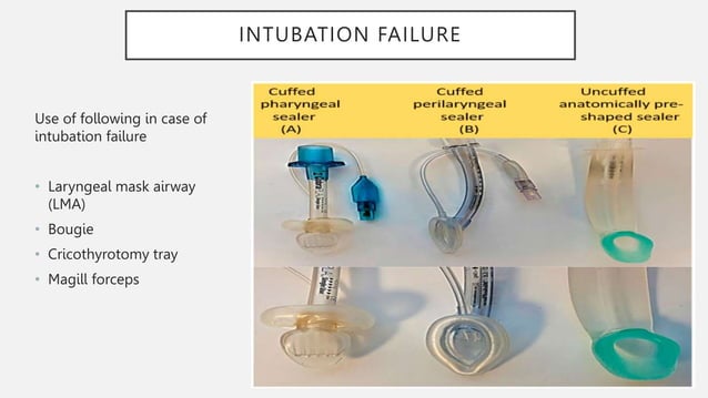Intubation.pptx | First Aid | Injuries