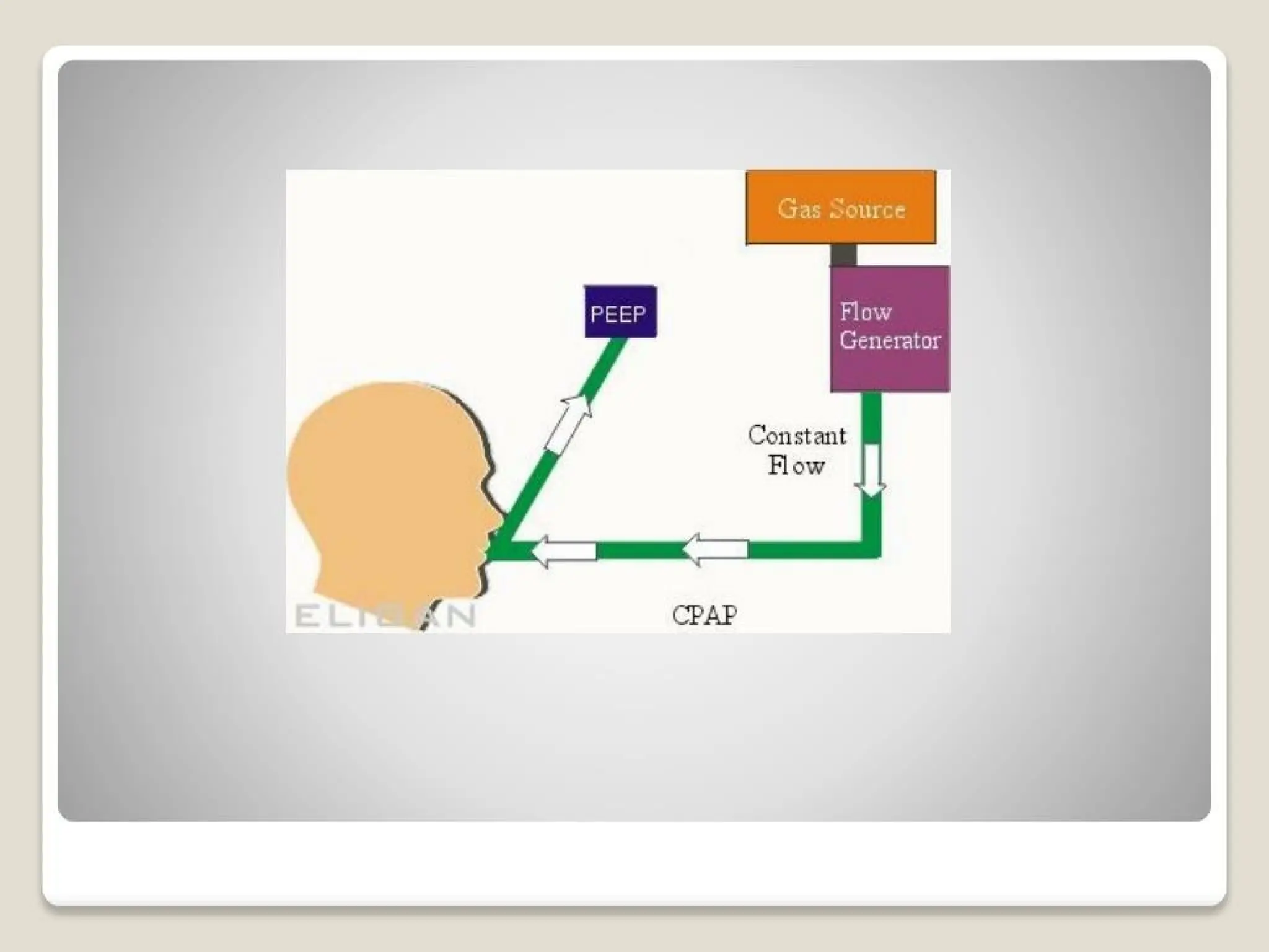 ventilators types and introduction .pptx