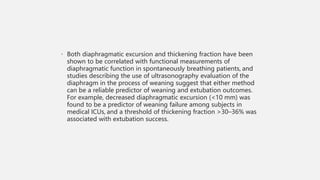 ventilator-induced diaphragmatic dysfunction.pptx