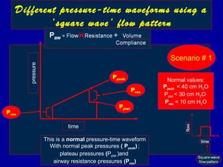 Ventilator 1 | PPT