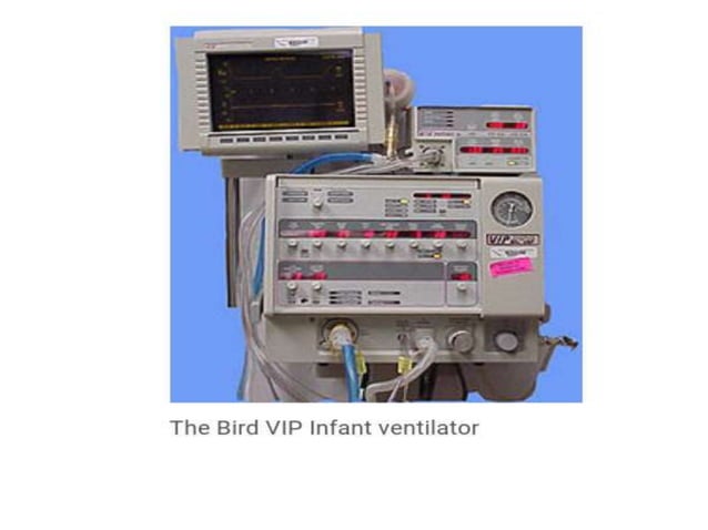 Ventilator | PPTX