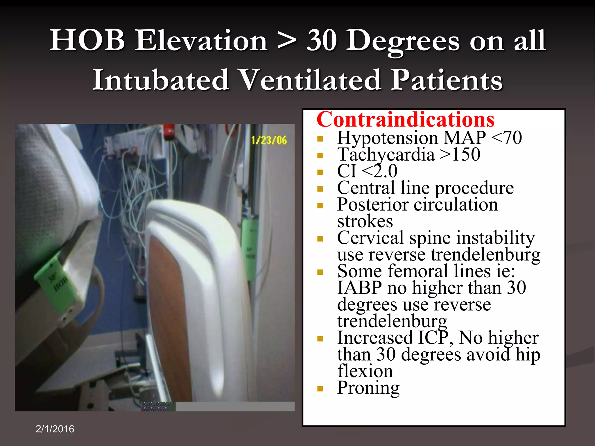 Ventilator associated pneumonia VAP | PPTX