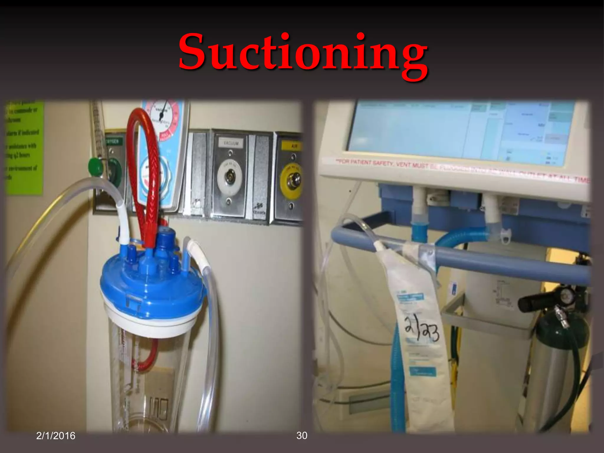 Ventilator associated pneumonia VAP | PPTX