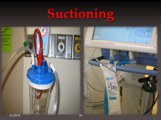 Ventilator associated pneumonia VAP | PPTX