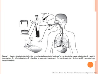 Ventilator Associated Pneumonia (VAP) or Hospital Acquired Pneumonia ...