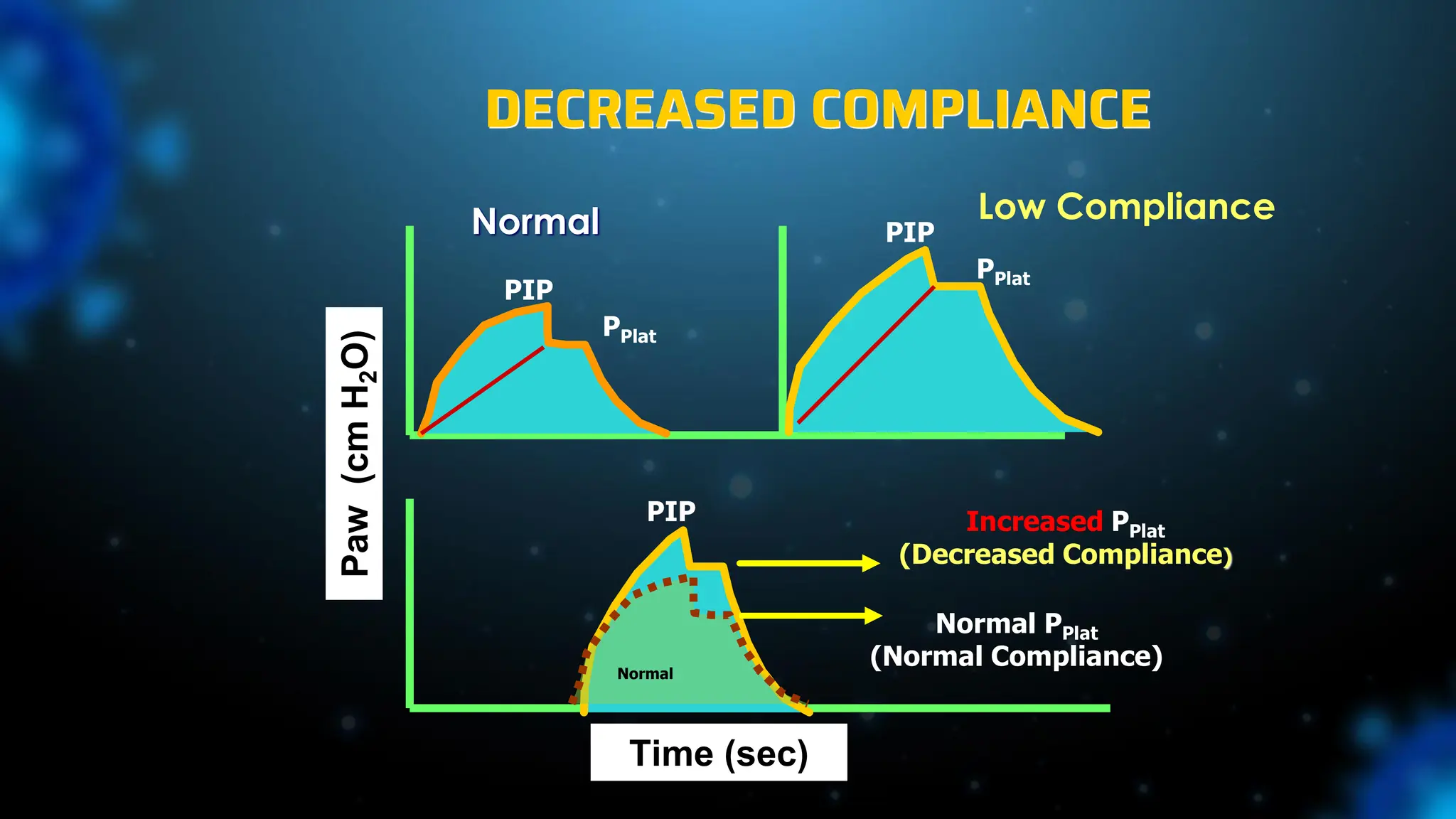 VENTILATOR ASYNCHRONY pathophysiology and clinical relevance | PDF