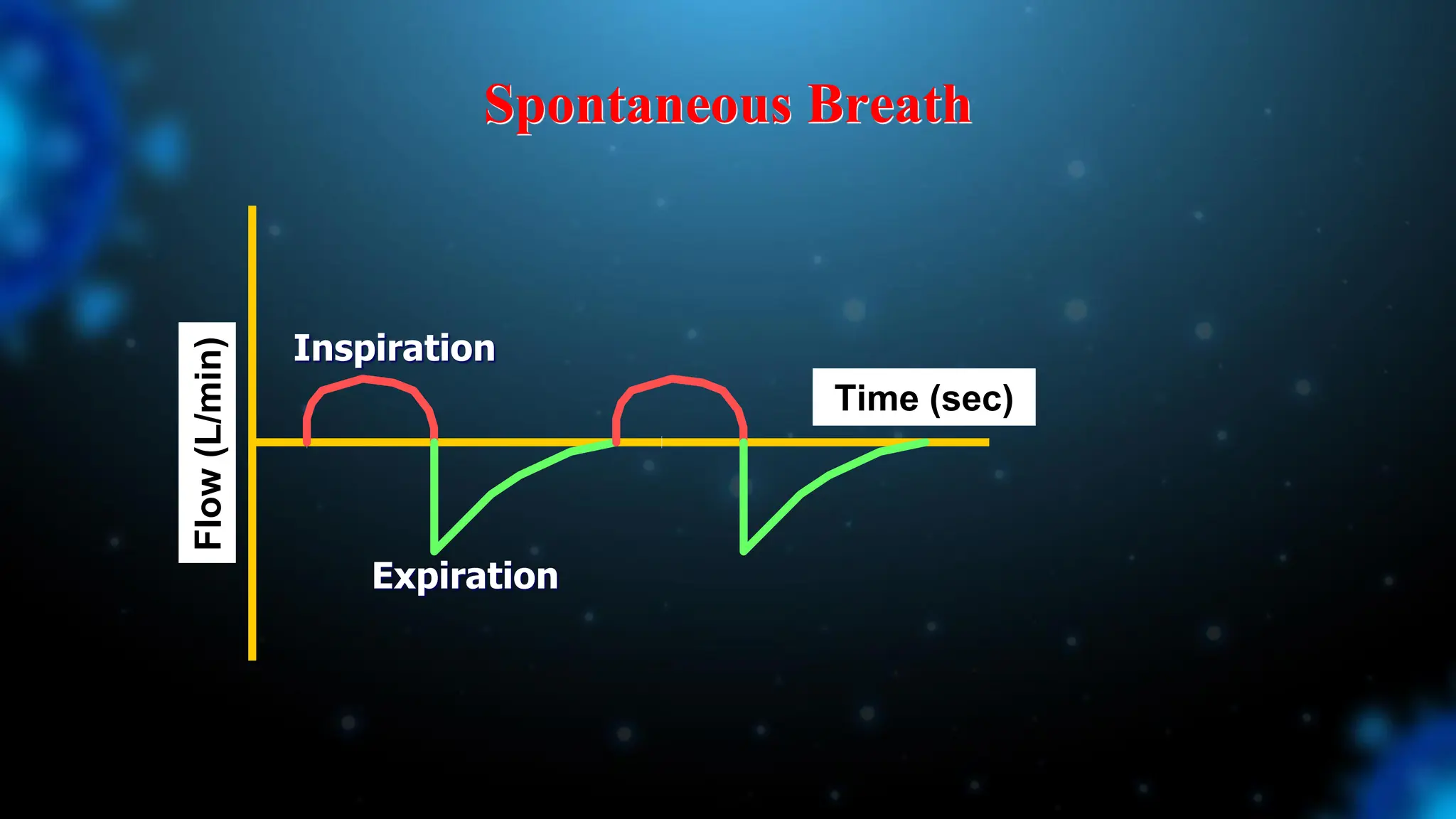 VENTILATOR ASYNCHRONY pathophysiology and clinical relevance | PDF