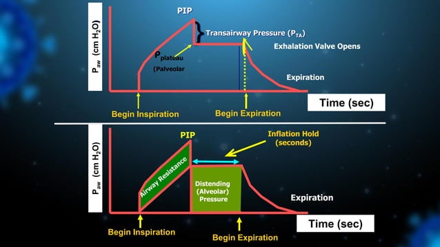 VENTILATOR ASYNCHRONY pathophysiology and clinical relevance | PDF ...