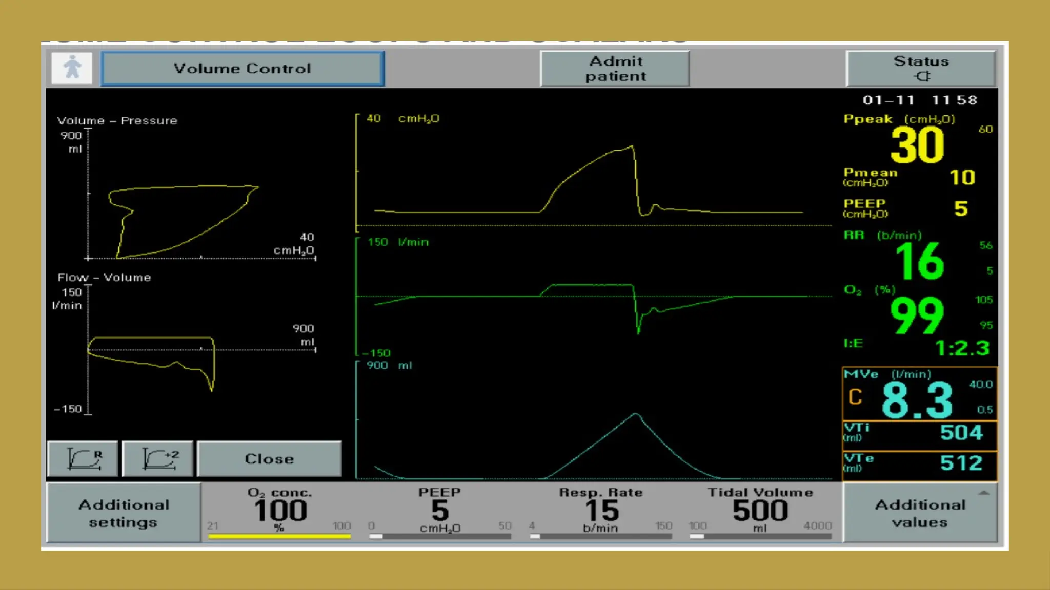 VENTILATOR basics with modes DR MANOJ.pptx