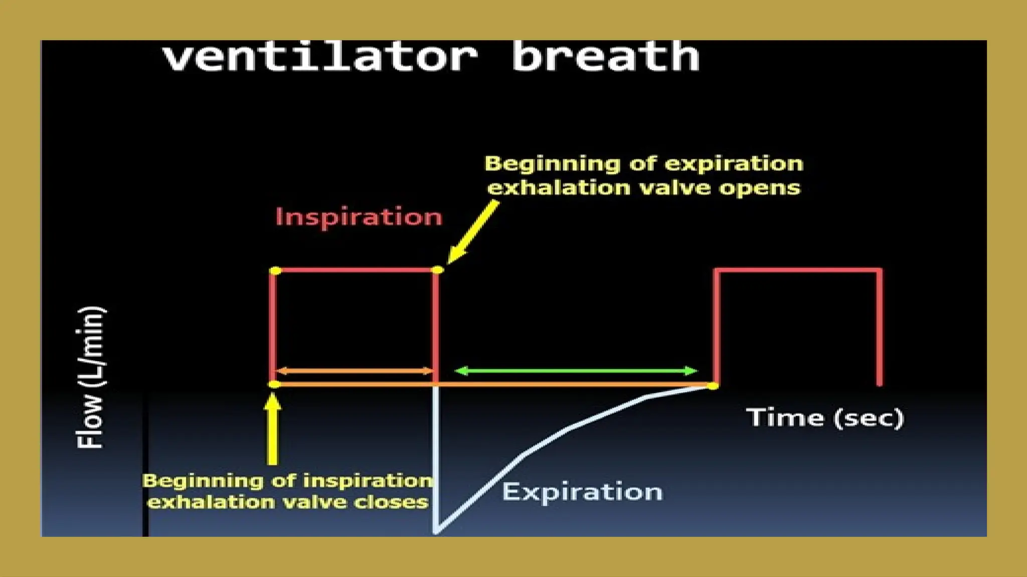 VENTILATOR basics with modes DR MANOJ.pptx