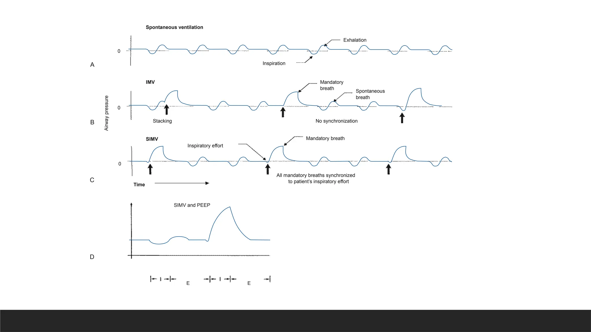VENTILATOR basics with modes DR MANOJ.pptx