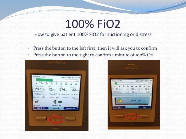 Ventilator Education VMP