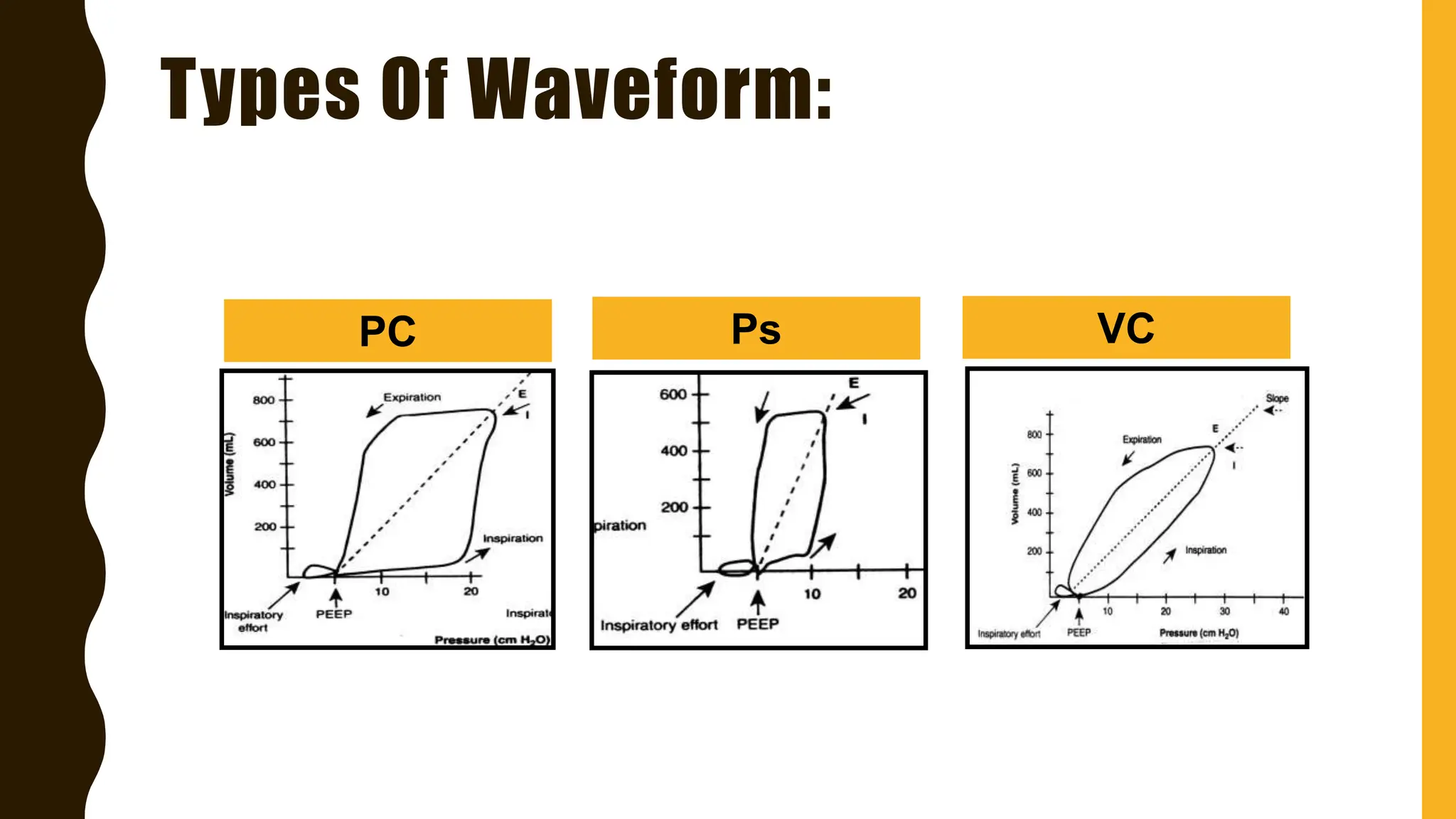 ventilator graphics that shows scalar and loops | PDF