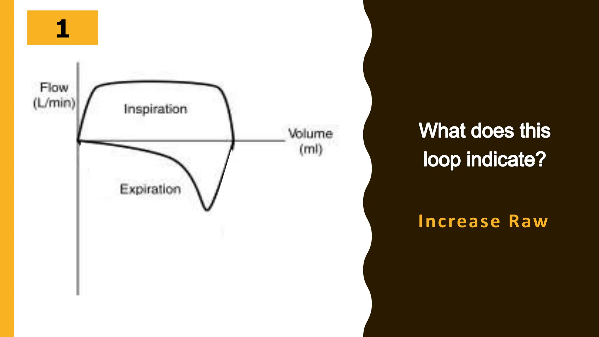ventilator graphics that shows scalar and loops | PDF