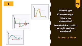 ventilator graphics that shows scalar and loops | PDF