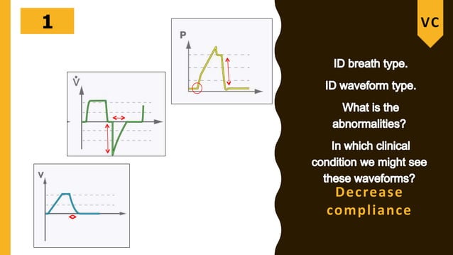 ventilator graphics that shows scalar and loops | PDF
